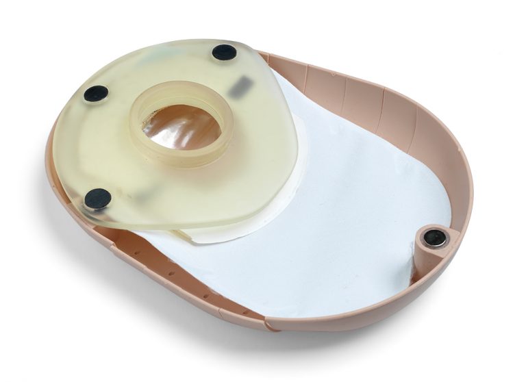 Ostomy innovation improving usability and visual appeal – Cambridge ...